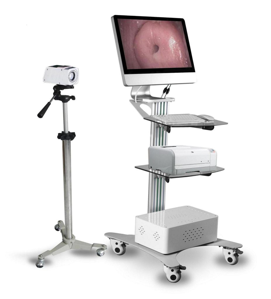 GYNE COLPOSCOPE | Aone Medical Equipment LLC